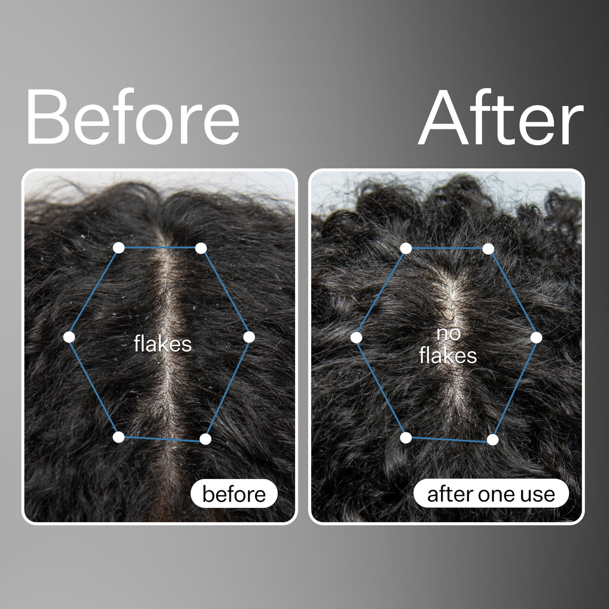 Scalp Build Up System – Act+Acre – Act+Acre UK
